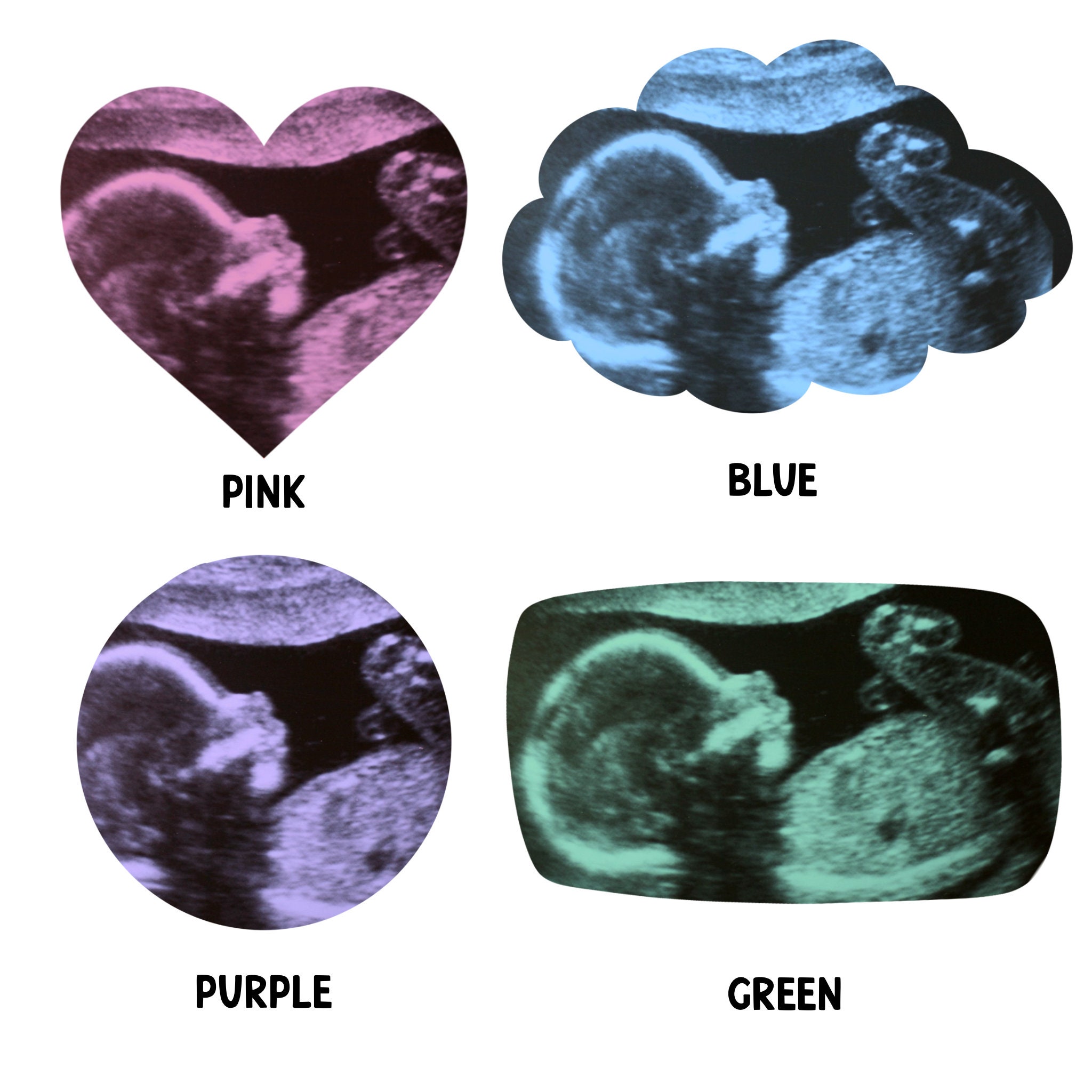 Personalised Ultrasound Birthday Card, From the Bump Sonogram Card ...