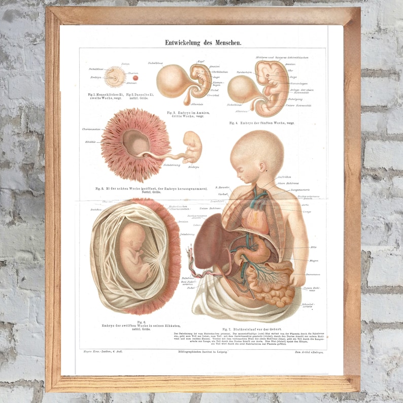 Art Nouveau Pregnancy Human Development 1900s Chromolithograph Vintage ...