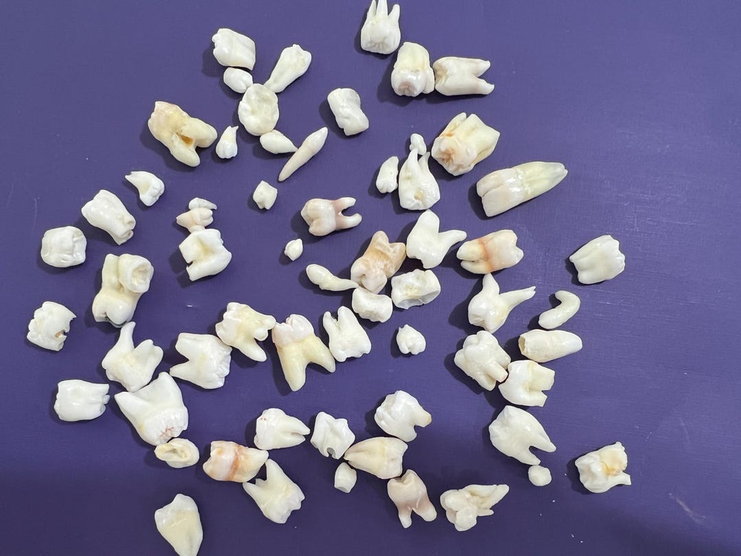 ONE (1X) ABNORMAL REAL Human Teeth - Etsy