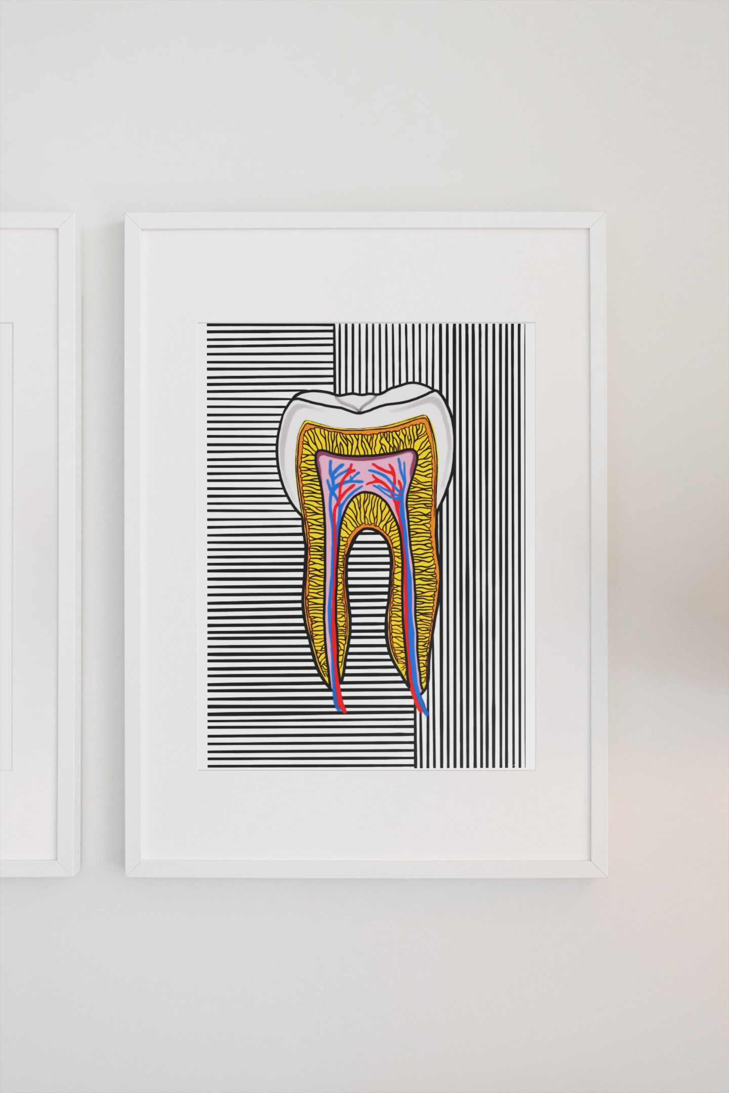 Dentist Office Decor, Molar Tooth Drawing, Dental Printable Art ...