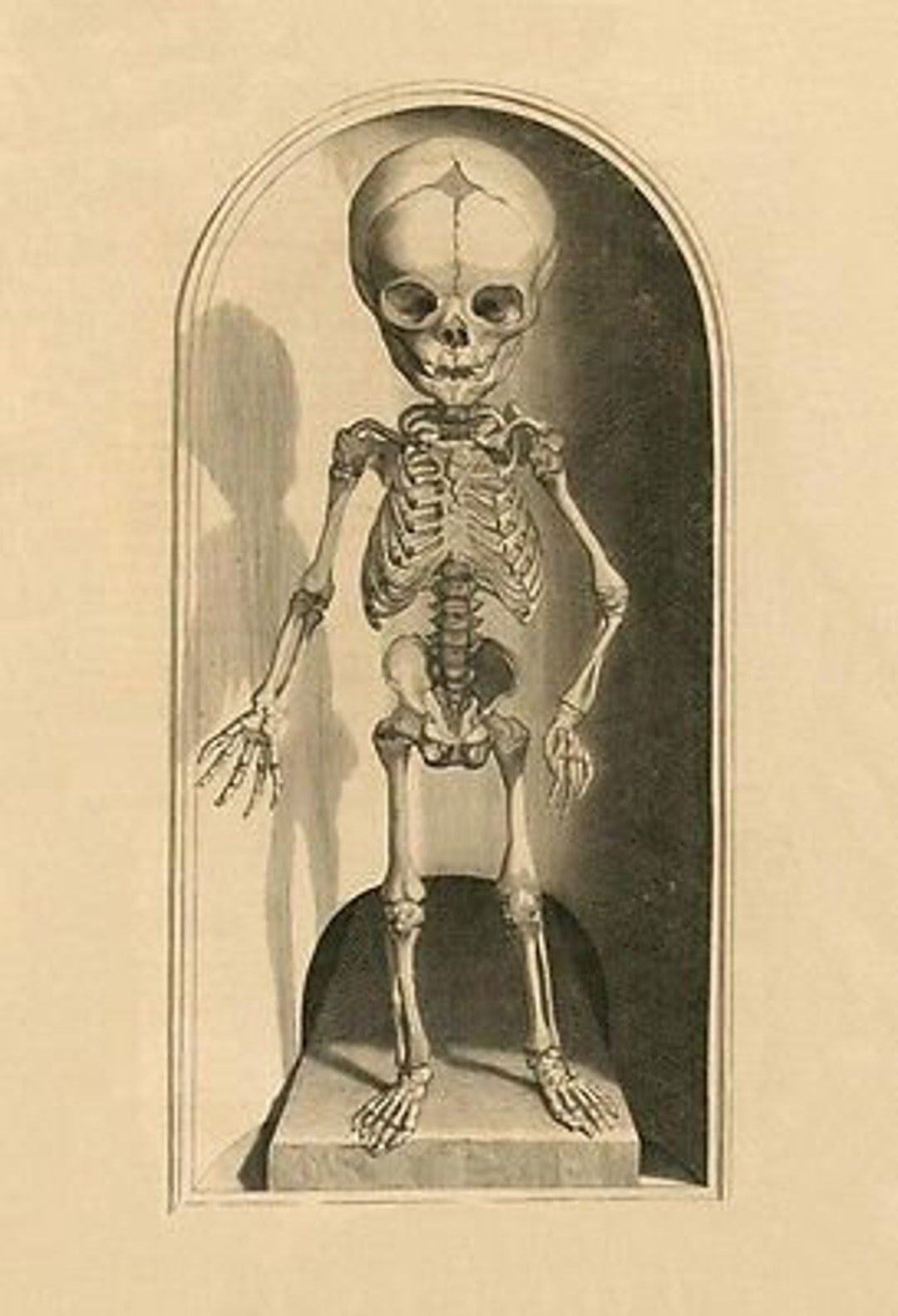 17th C. Infant Skeleton Medical A3 Poster Re Print - Etsy