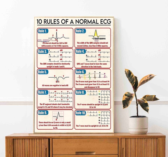 10 Rules of A Normal ECG Poster Electrocardiogram Knowledge - Etsy