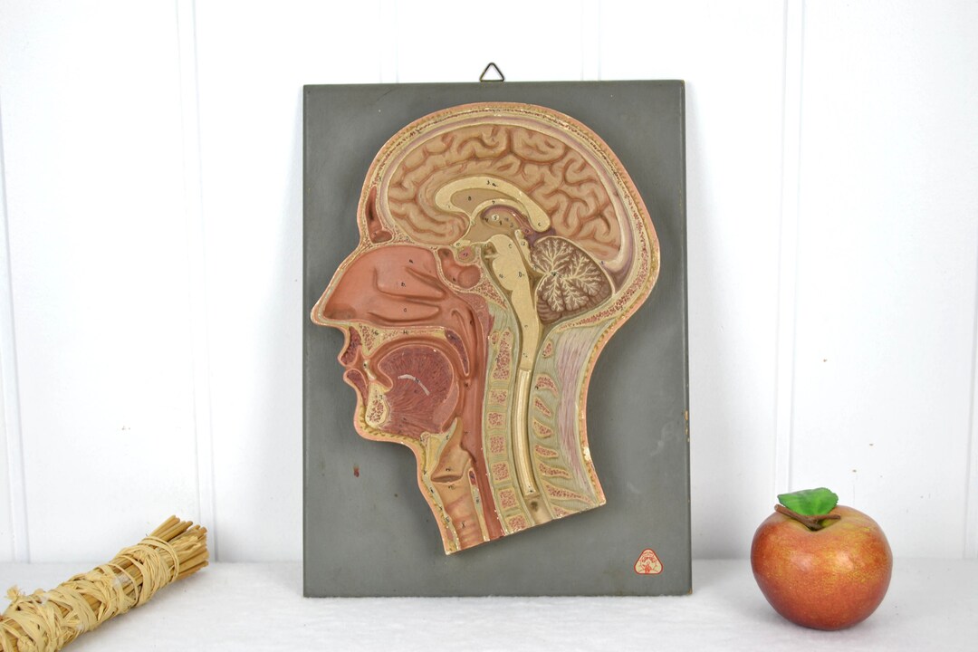 Somso Head Cutaway Model 50s Anatomy Marcus Sommer Sonneberg Head Brain ...