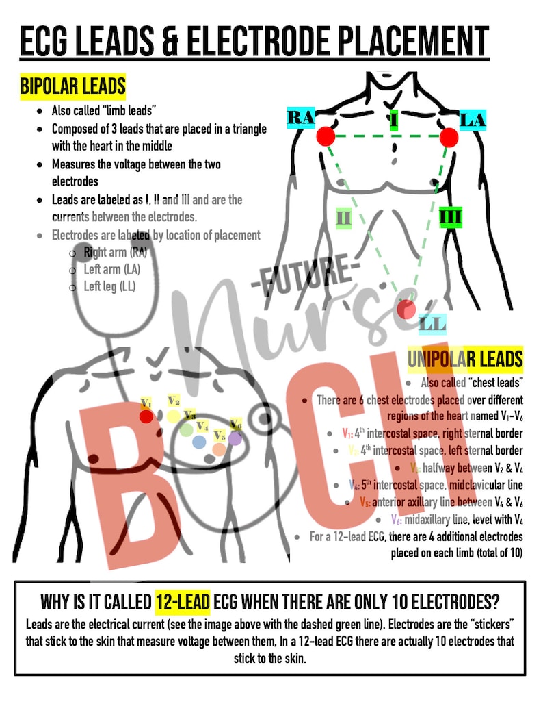 ECG and Rhythms Nursing School Notes - Etsy