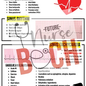 ECG and Rhythms Nursing School Notes - Etsy