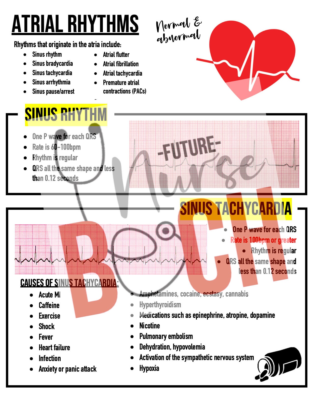 ECG and Rhythms Nursing School Notes - Etsy