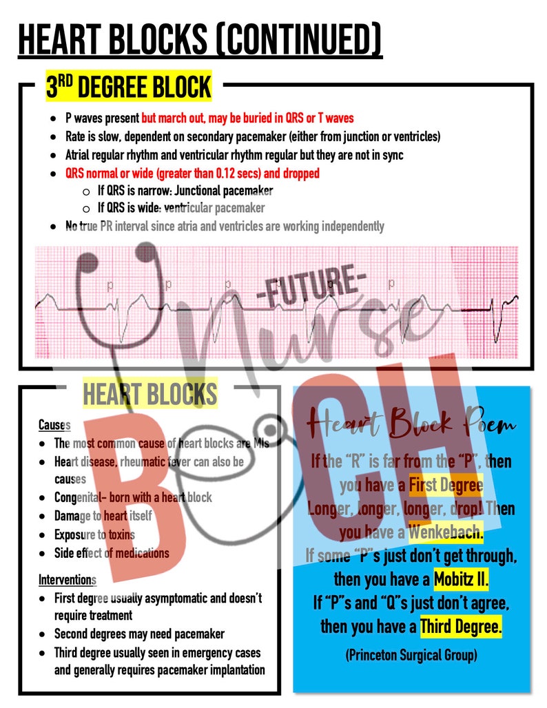 ECG and Rhythms Nursing School Notes - Etsy