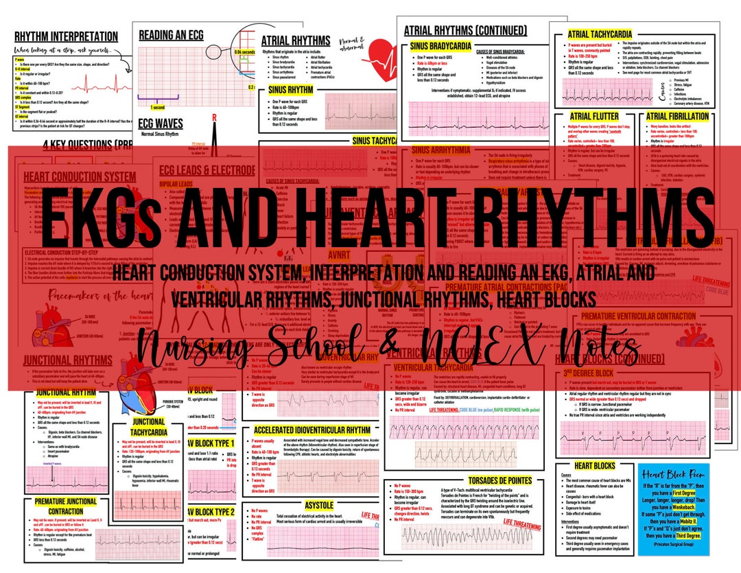 ECG and Rhythms Nursing School Notes - Etsy