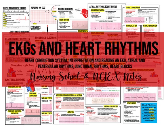 ECG and Rhythms Nursing School Notes - Etsy