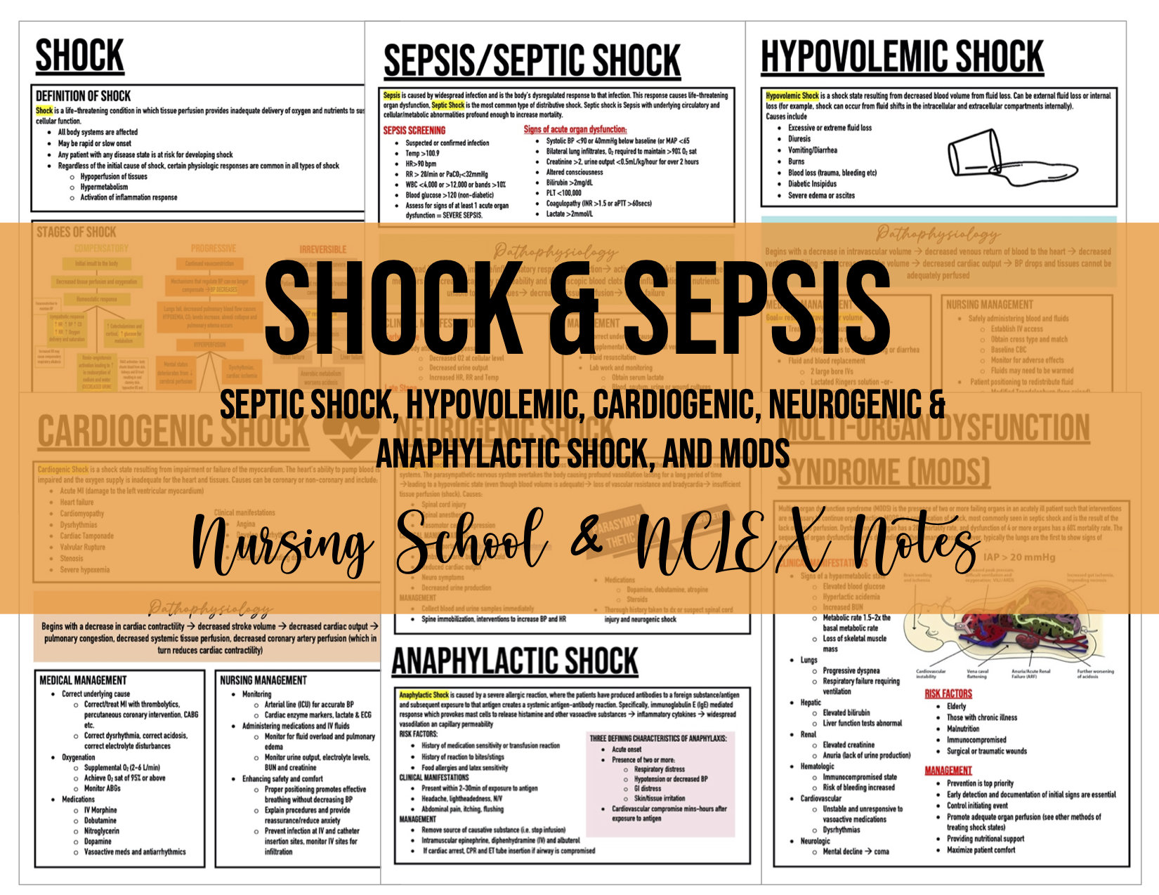Shock and Sepsis Nursing School Notes - Etsy