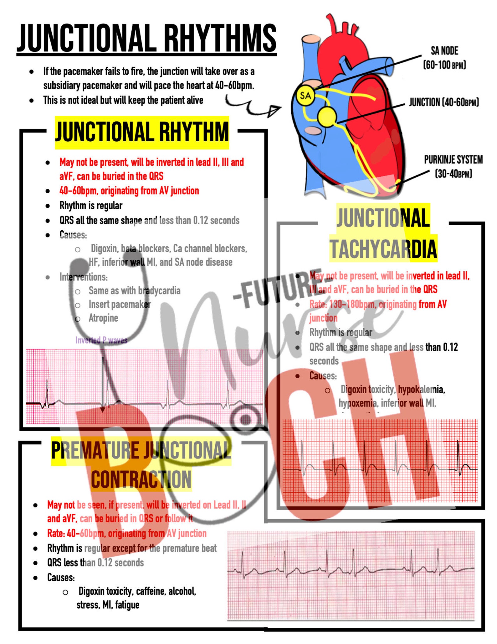 ECG and Rhythms Nursing School Notes - Etsy