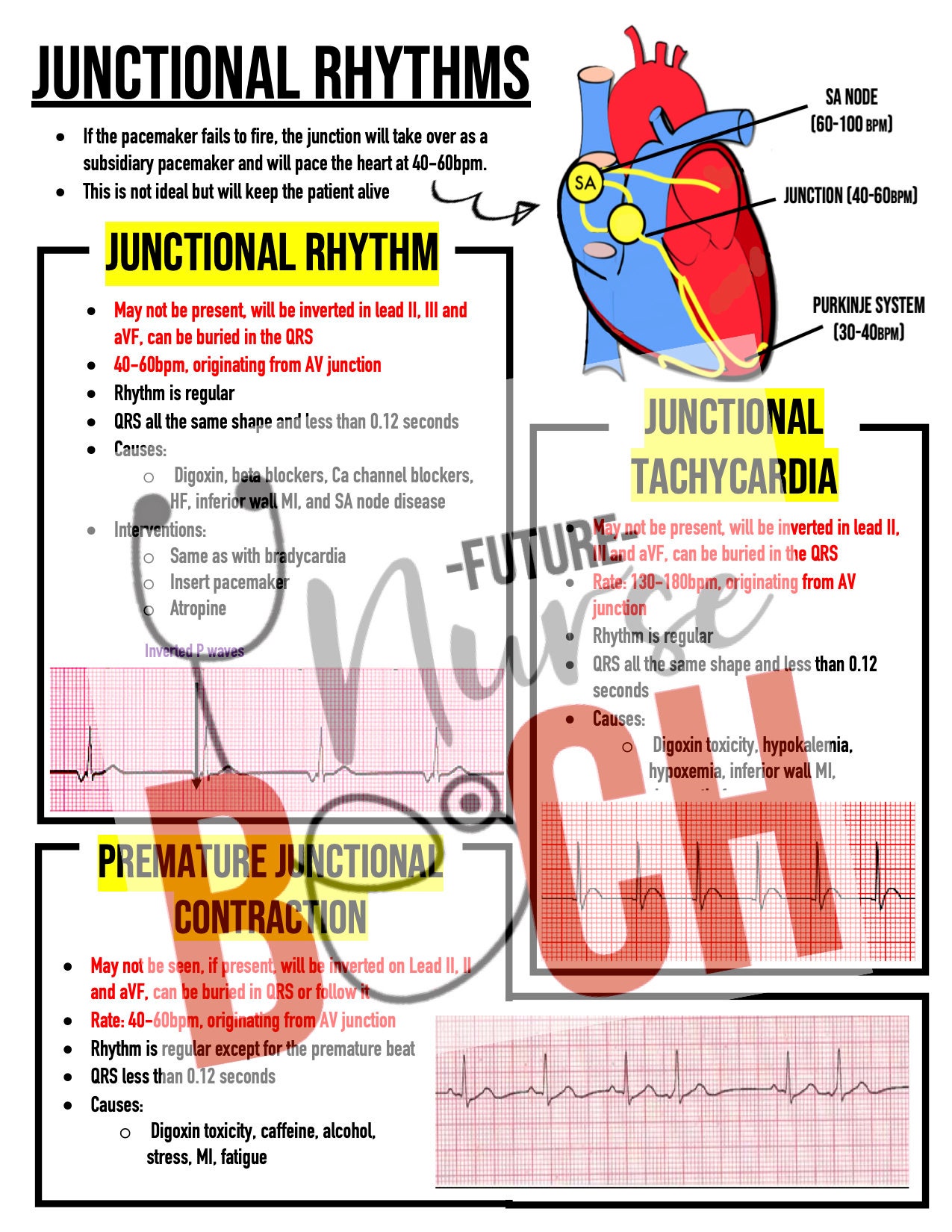 ECG and Rhythms Nursing School Notes - Etsy