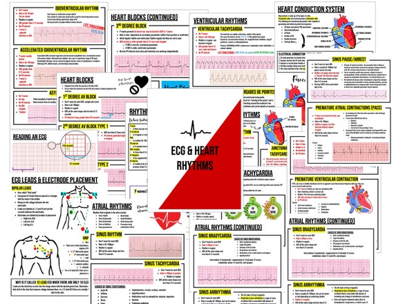 ECG and Rhythms Nursing School Notes | Etsy