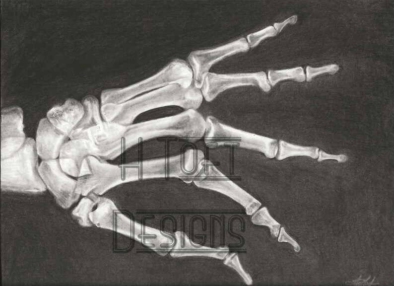 Original Drawing, Charcoal Drawing of an X Ray Hand - Etsy