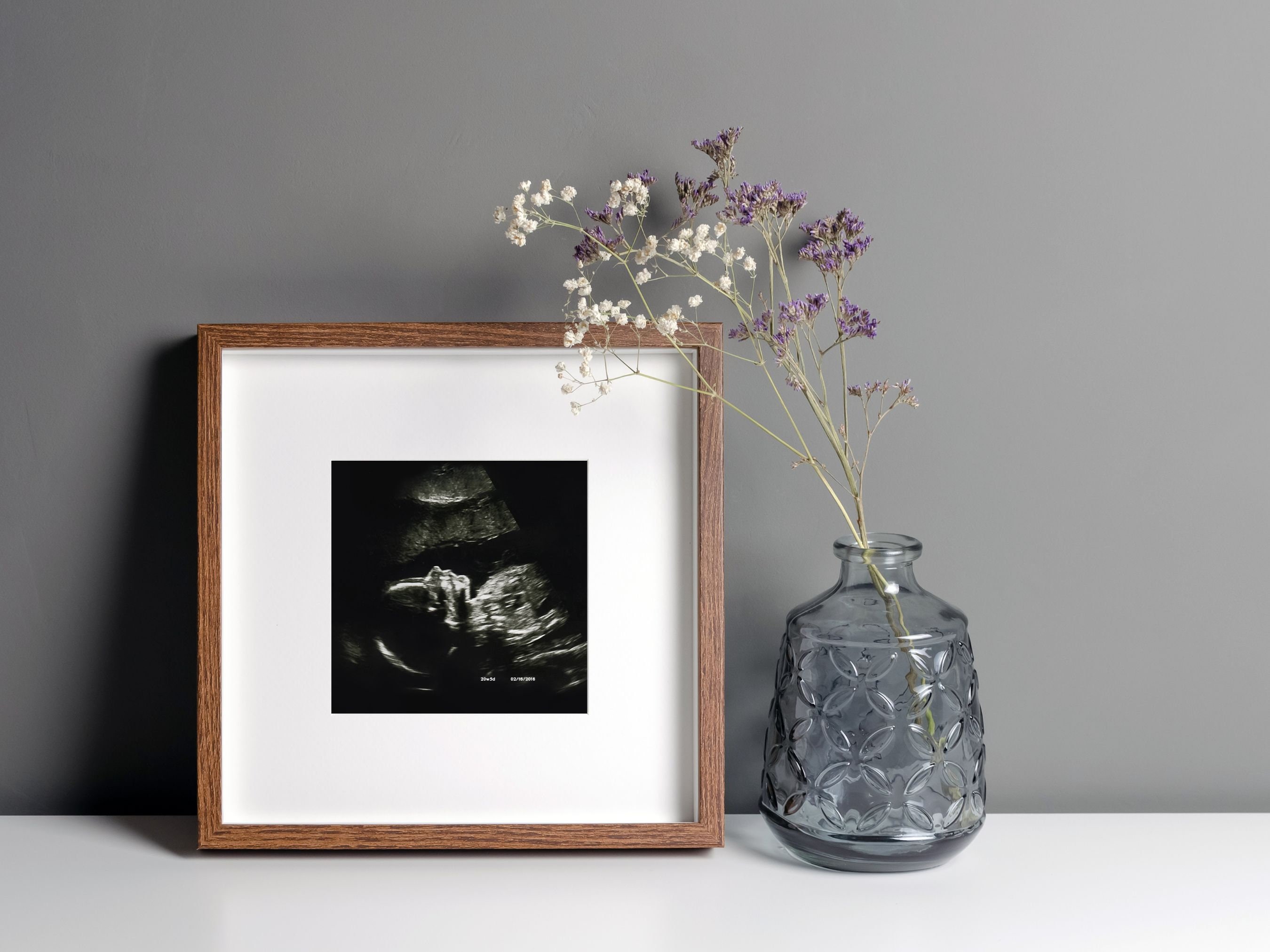 Baby Sonogram Print, Ultrasound Picture Display, Baby Keepsakes ...