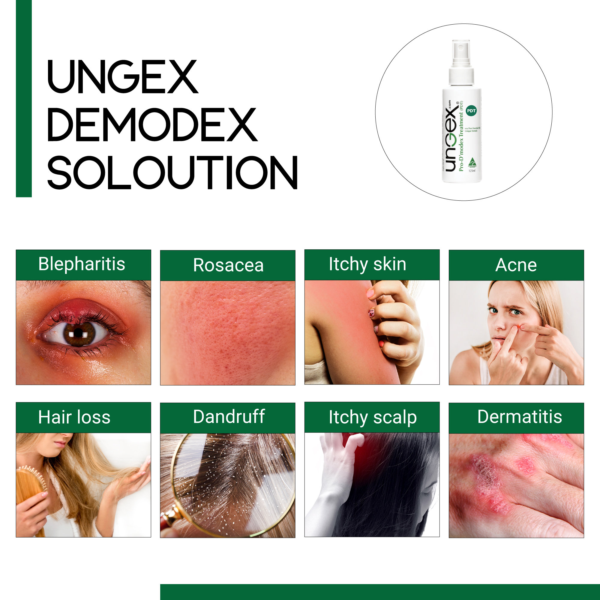 Ease Demodex Infestation On Scalp Face Body Treat All Skin Mites