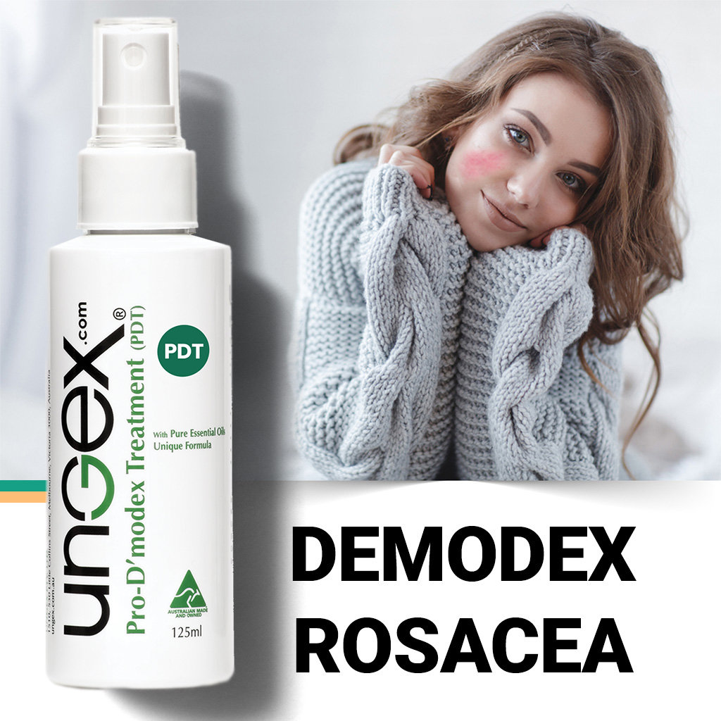 Scalp and Skin Demodex Mites to Treat Pimple Acne Rosacea, Itchy ...