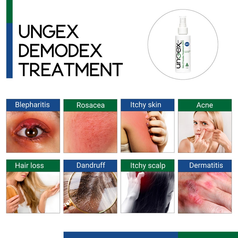 Demodex Solution Starter Pack (DSSP) - Clear & Mite-free Skin Care - Etsy