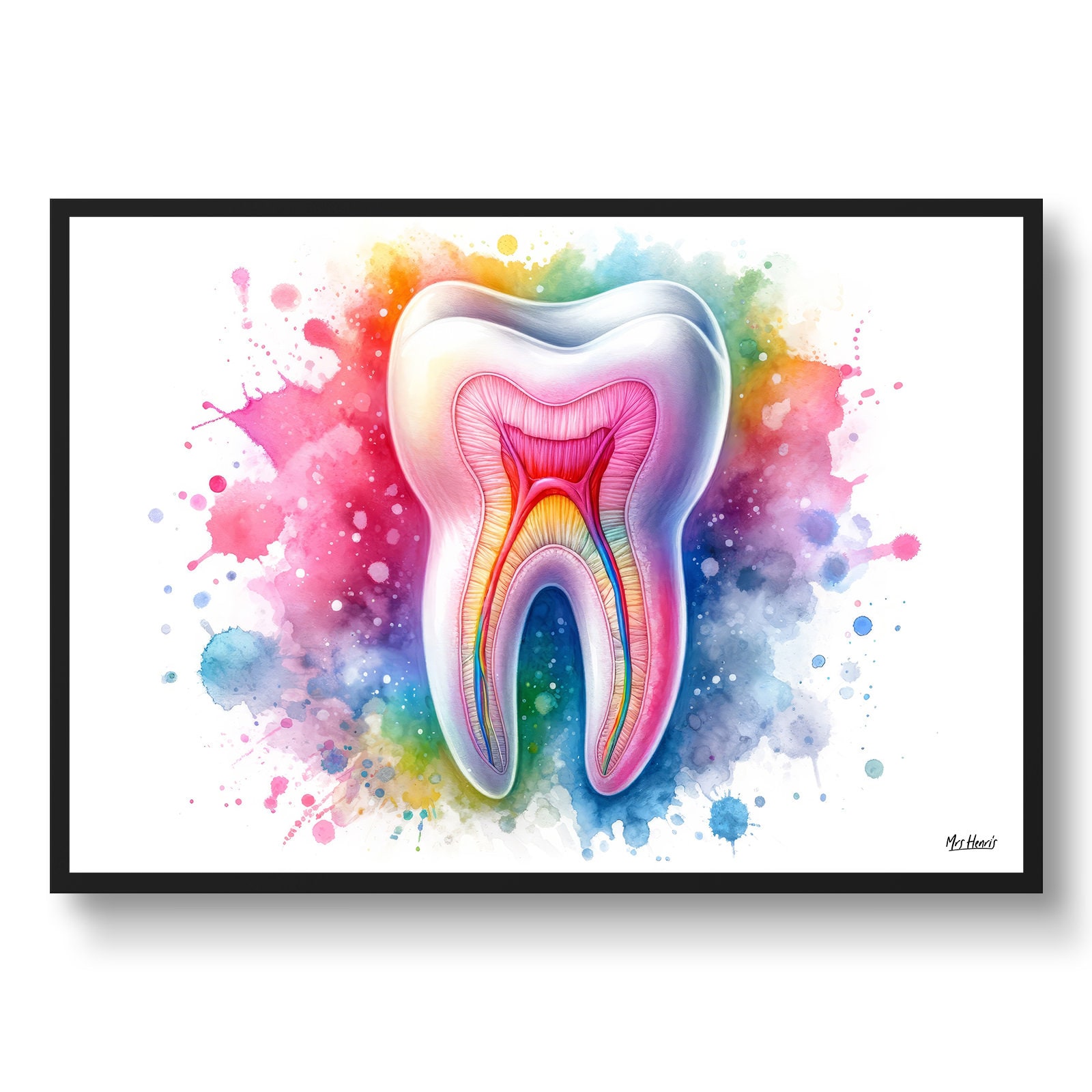 Molar Tooth Art Print Dental Dentist Wall Art Print Watercolour Molar ...