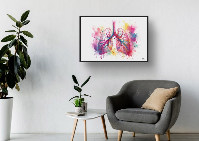 Lungs Art Print Pulmonary Angiography Radiology Wall Art Print ...