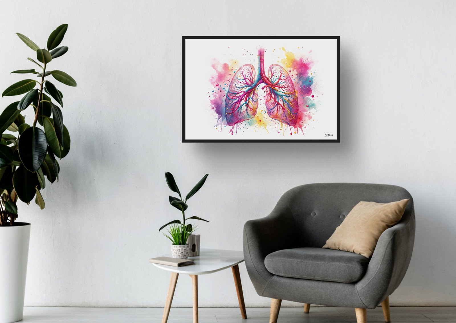Lungs Art Print Pulmonary Angiography Radiology Wall Art Print ...