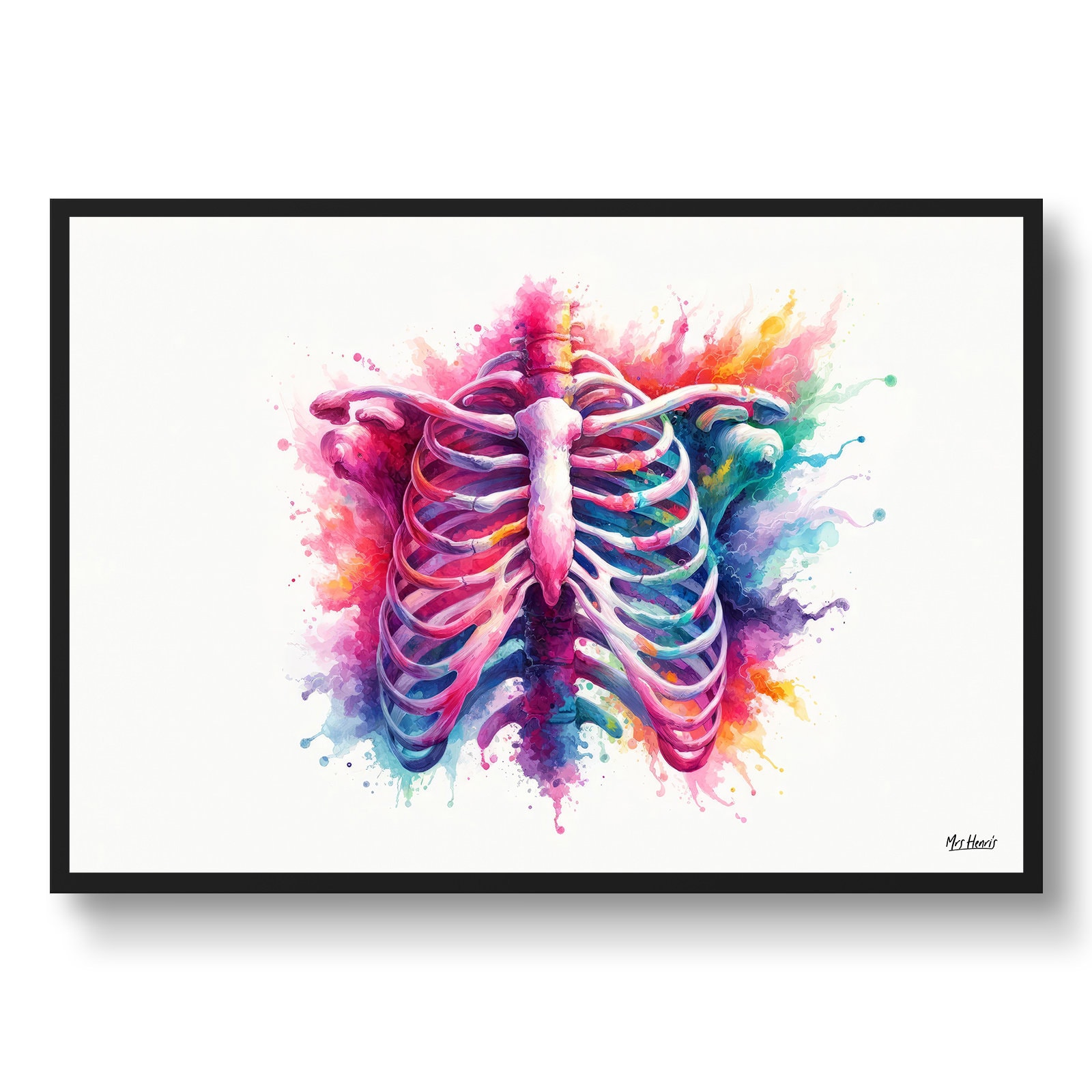 Thorax Rib Cage Sternum Wall Art Print Watercolour Thorax Medical ...