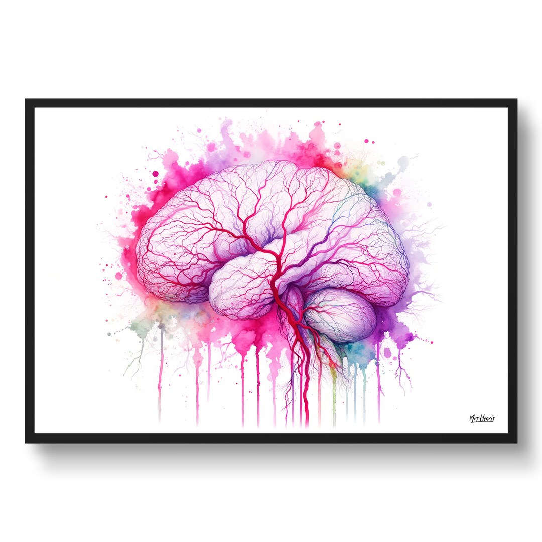 Cerebral Angiography Side Vascularization Neurology Wall Art Print ...