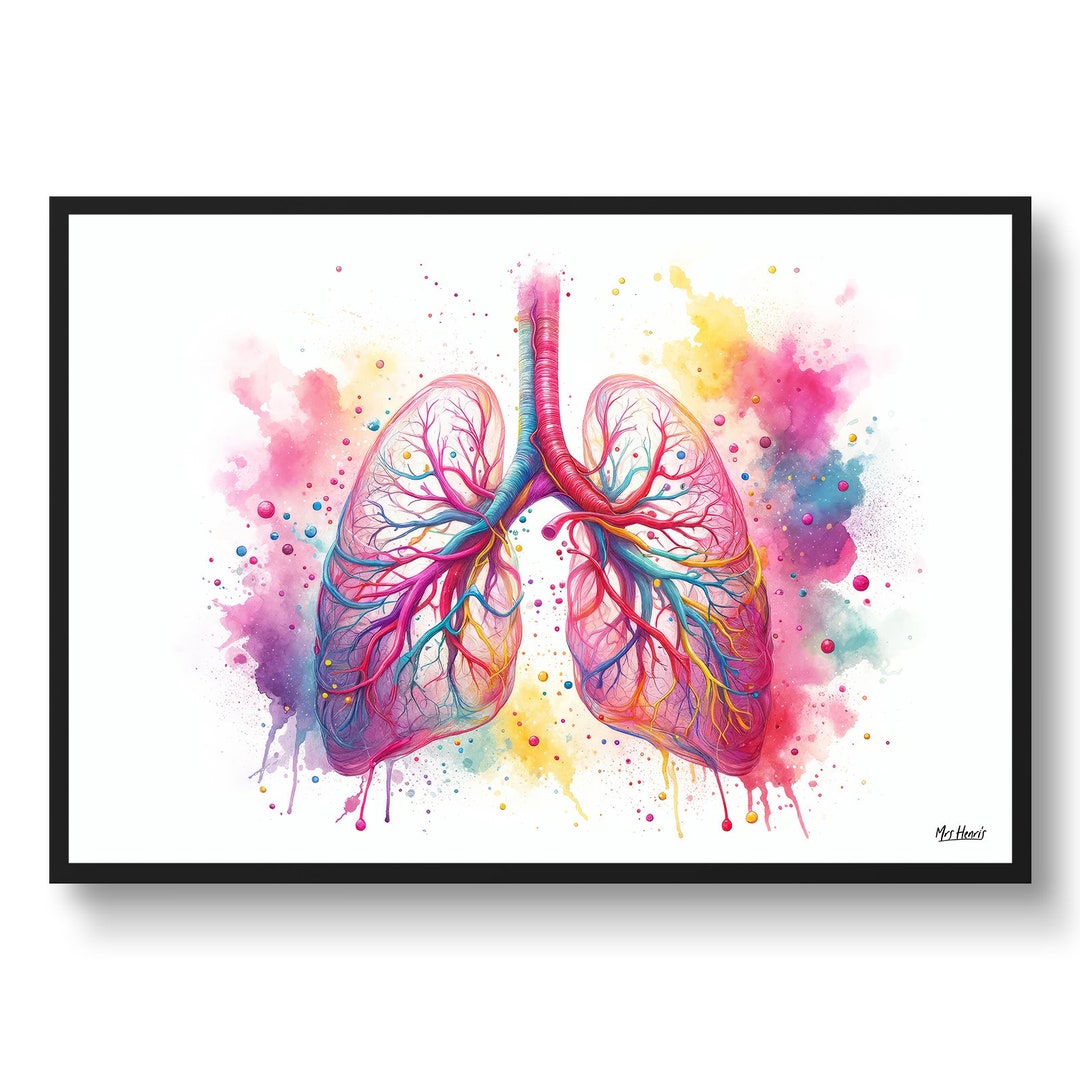 Lungs Art Print Pulmonary Angiography Radiology Wall Art Print ...