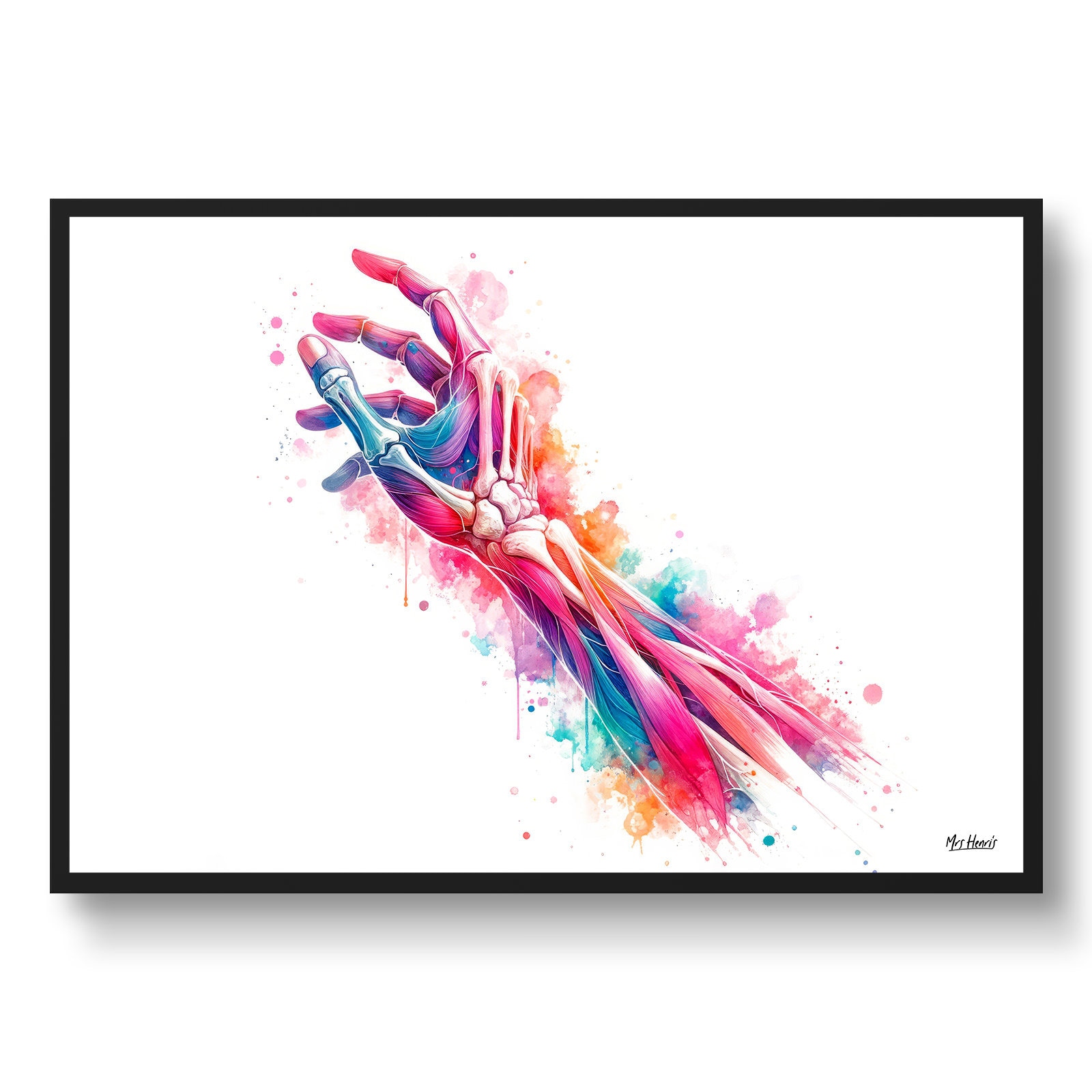Forehand Outside Ligaments Physiotherapy Wall Art Print Watercolour ...