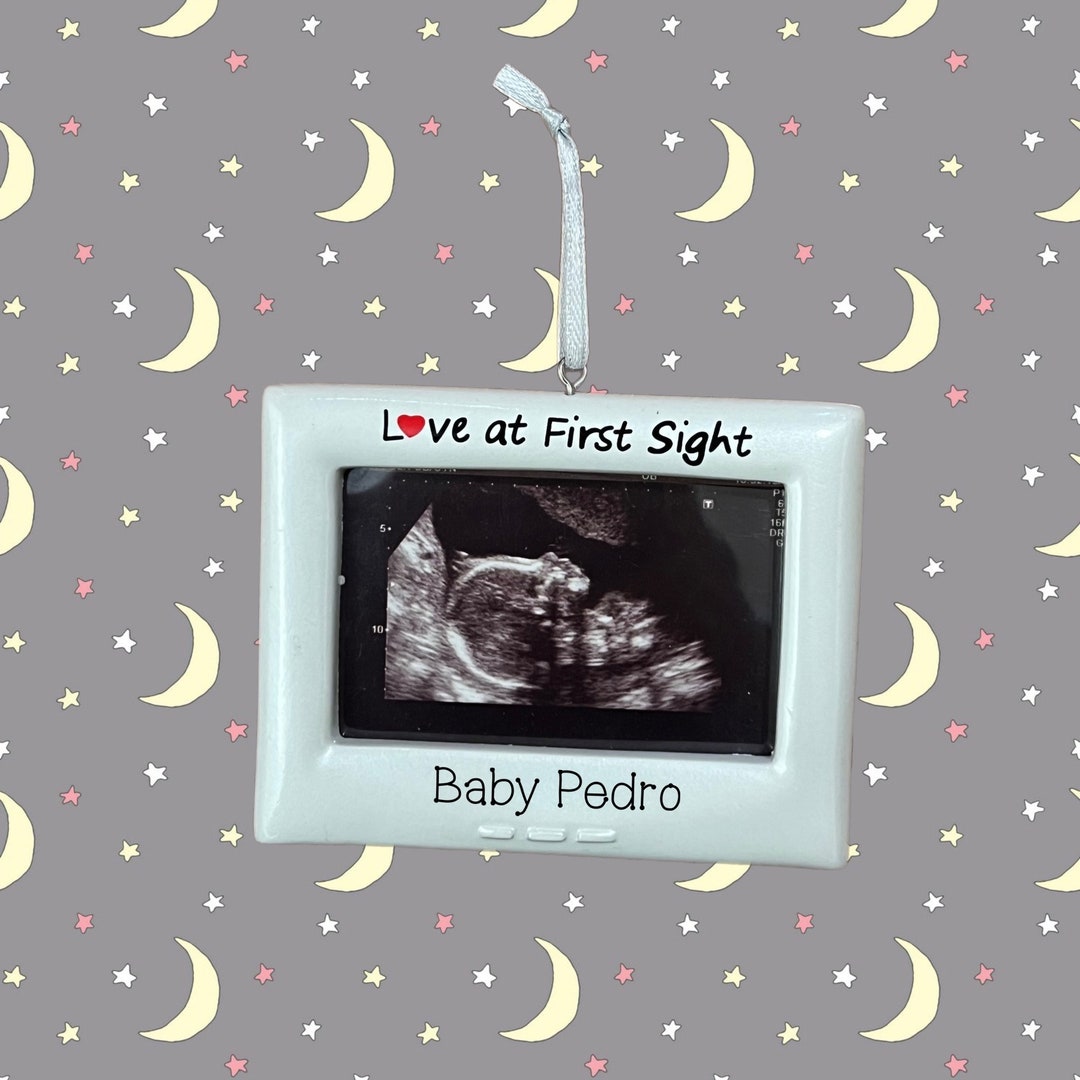 Personalized Love at First Sight Baby Ultrasound Ornament - Etsy