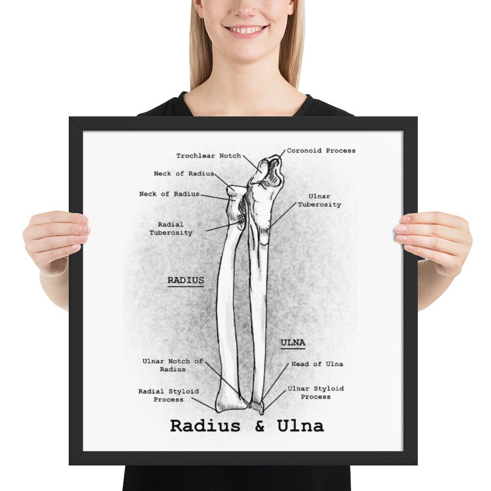Ulnar Notch Of Radius