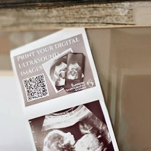 Traditional Ultrasound Strip - Upload Your Digital Images - Etsy