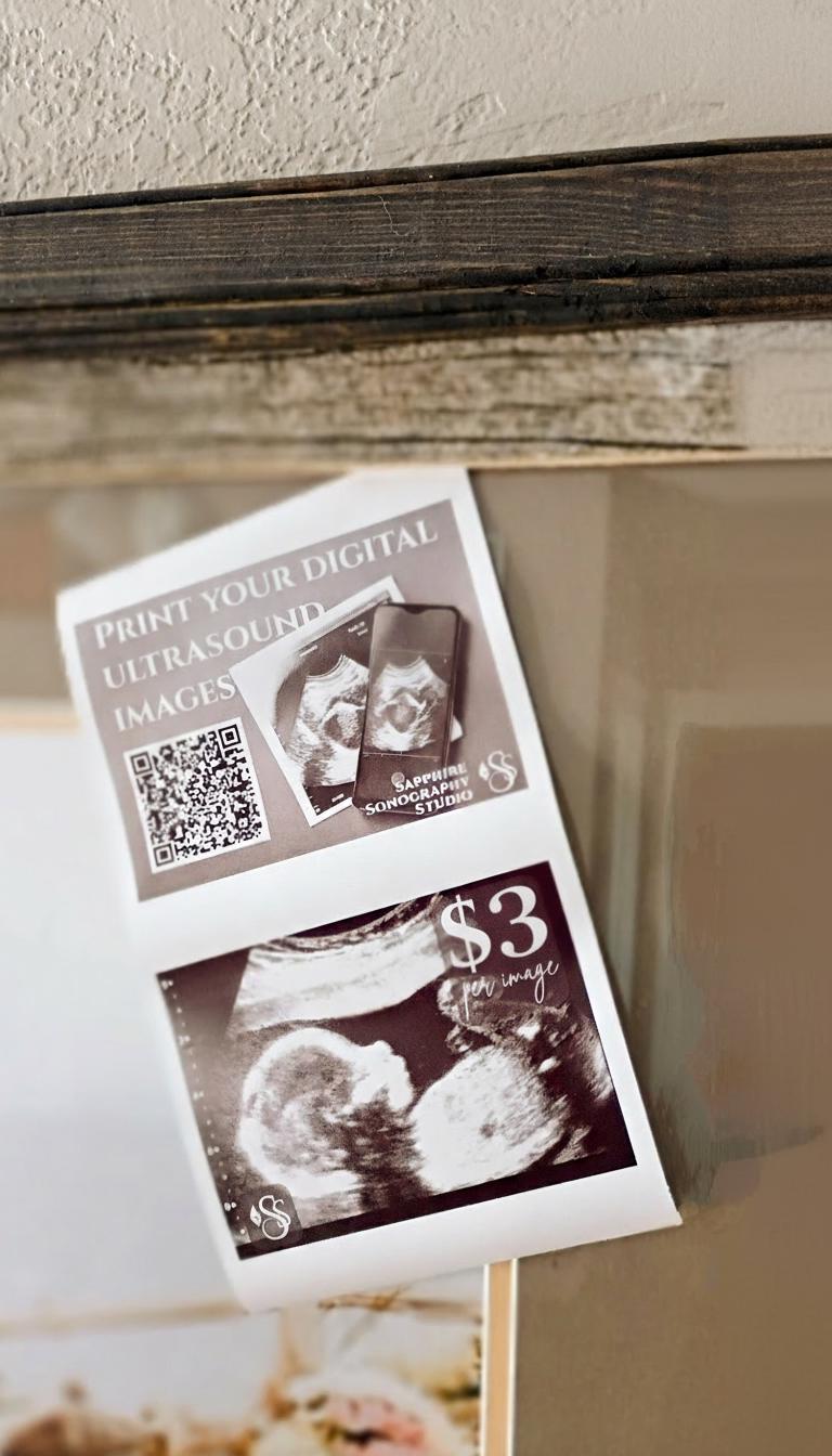 Traditional Ultrasound Strip - Upload Your Digital Images - Etsy