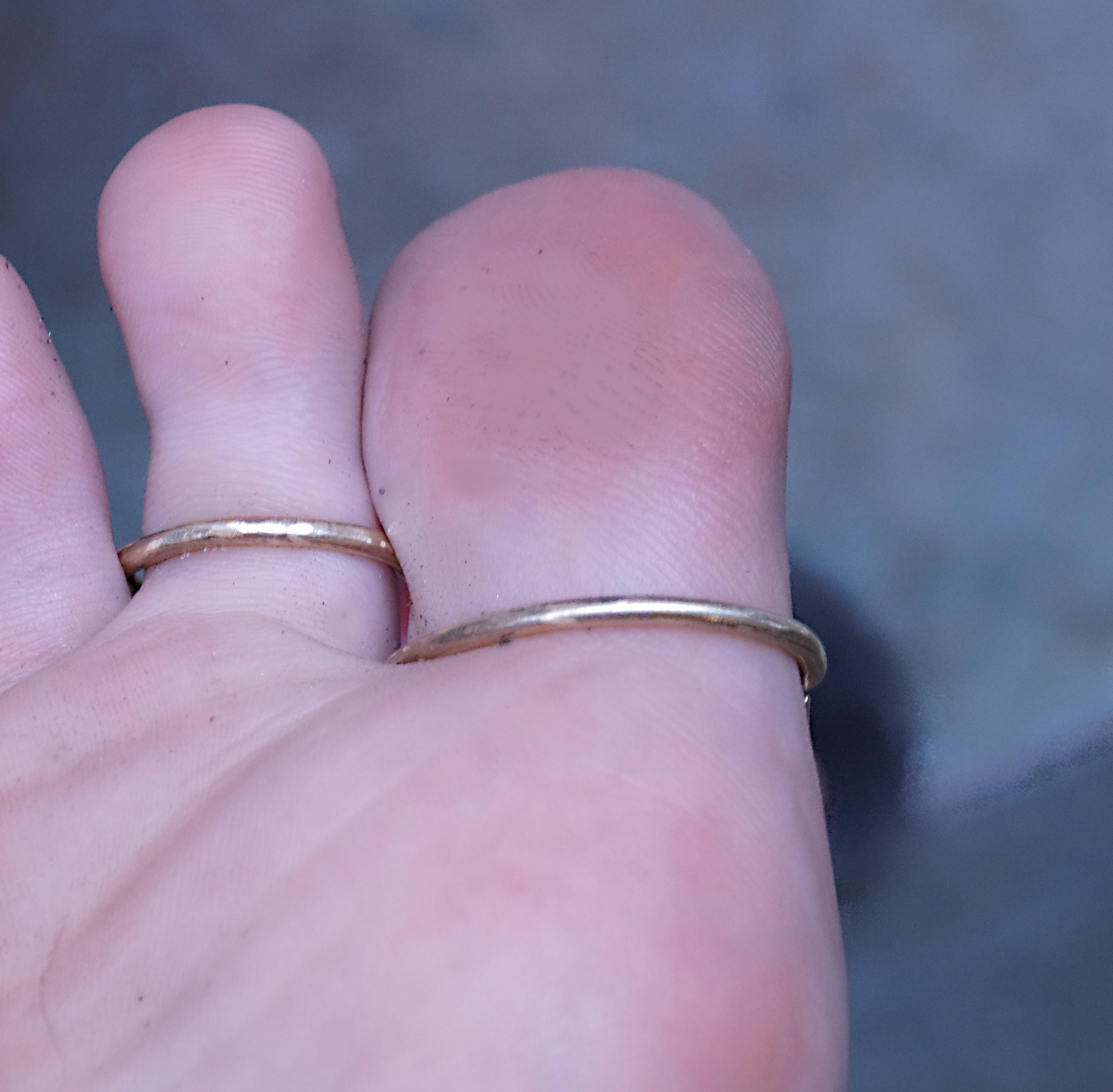 Arthritis Toe Splint EDS Two Rings Splint Adjustable | Etsy