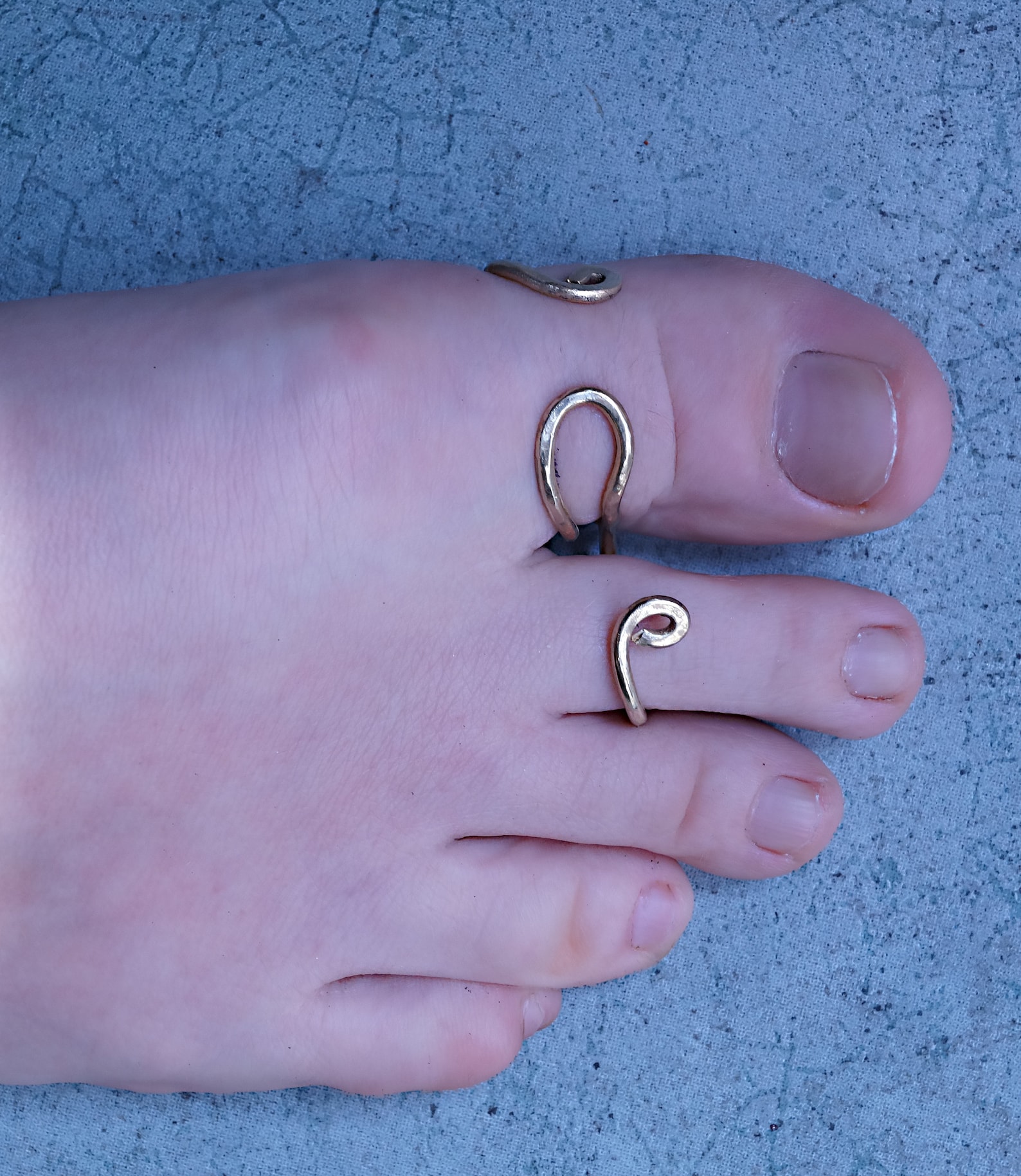 Arthritis Toe Splint EDS Two Rings Splint Adjustable - Etsy