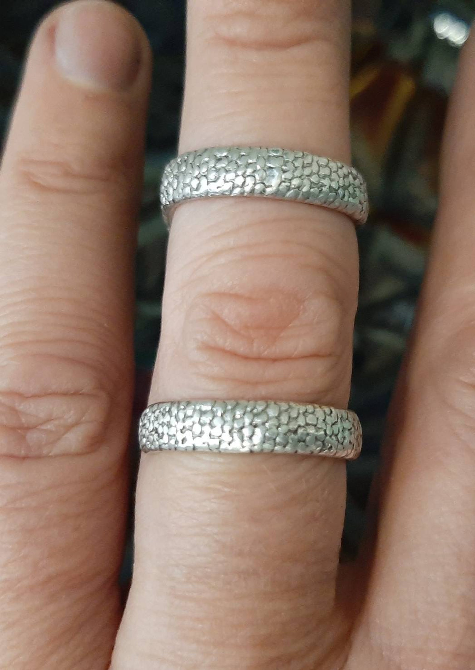 Finger Ring Splint Adjustable Snake - Etsy