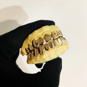 Custom Grillz 10pc on 10pc Solid Gold - Etsy