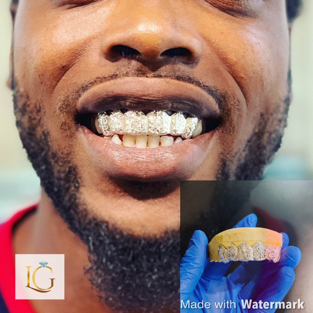 6 Teeth (princess Cuts W/ Diamond Dust) - Etsy