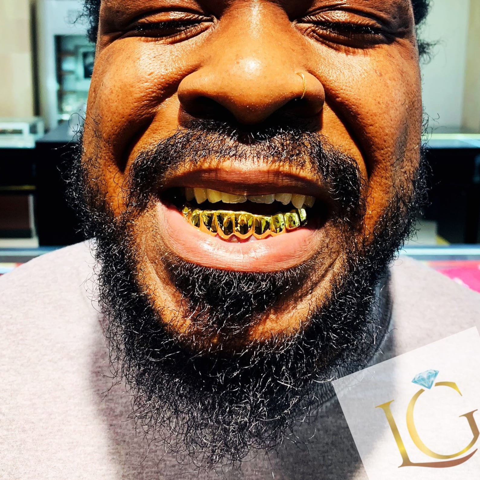 Custom Grillz 10pc on 10pc Solid Gold - Etsy