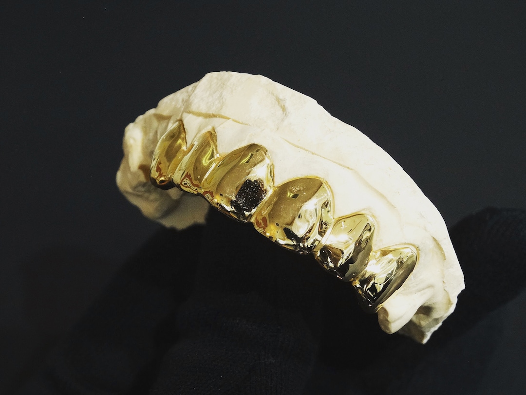 6 Teeth (rose, Yellow, White Color Choices) - Etsy