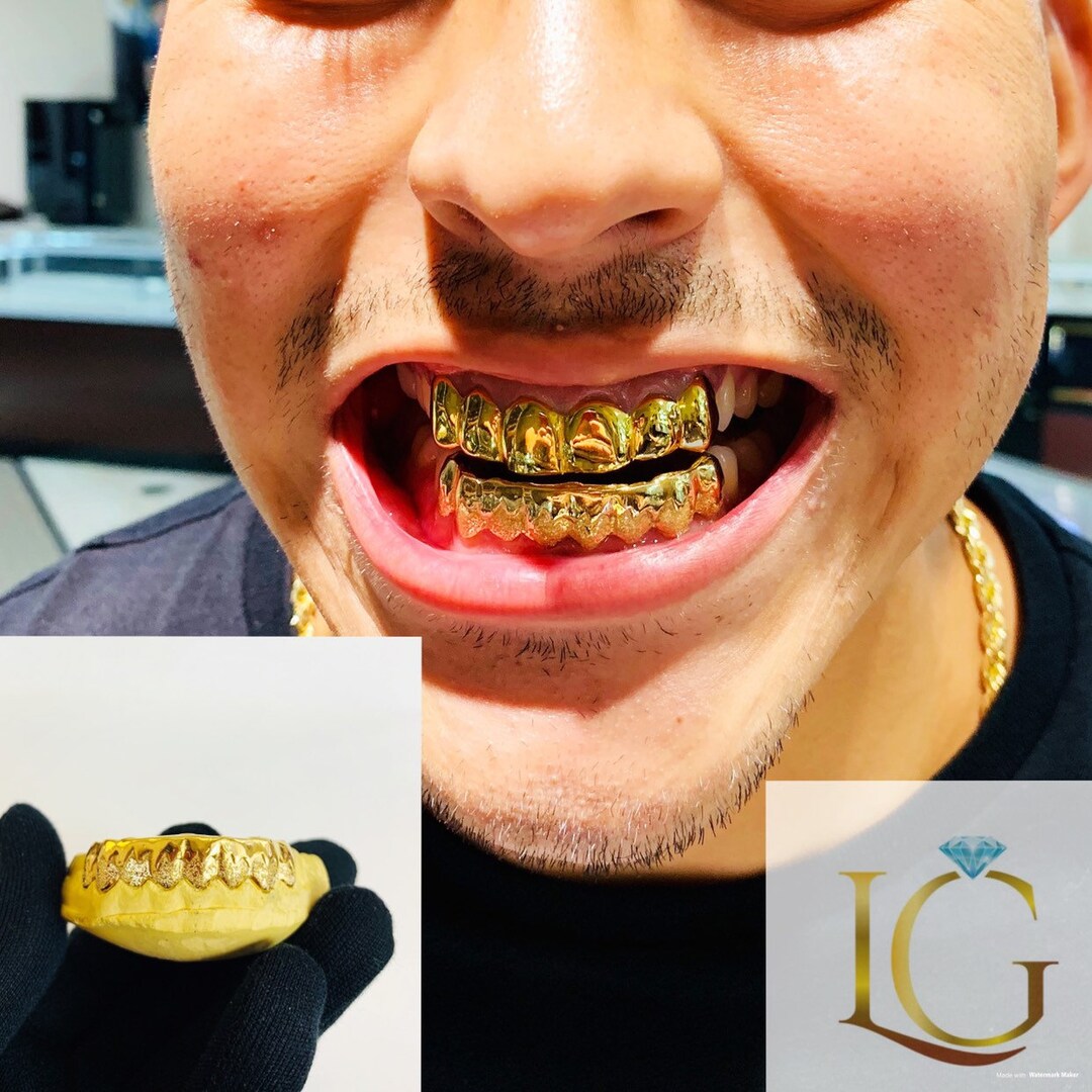 8 Teeth dripping Style Over Diamond Dust-3d Custom - Etsy