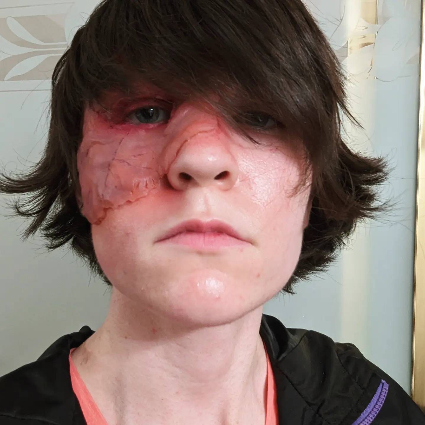 Avatar Zuko Scar Prosthetic Cosplay Accessory - Latex-free Fake Glue-on ...