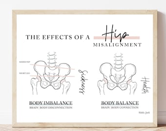 Hip Misalignment Print // Spinal Nerve Chart // Chiropractic | Etsy Ireland