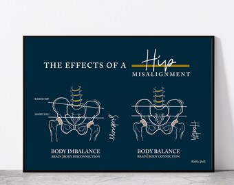 Hip Misalignment Print // Spinal Nerve Chart // Chiropractic | Etsy