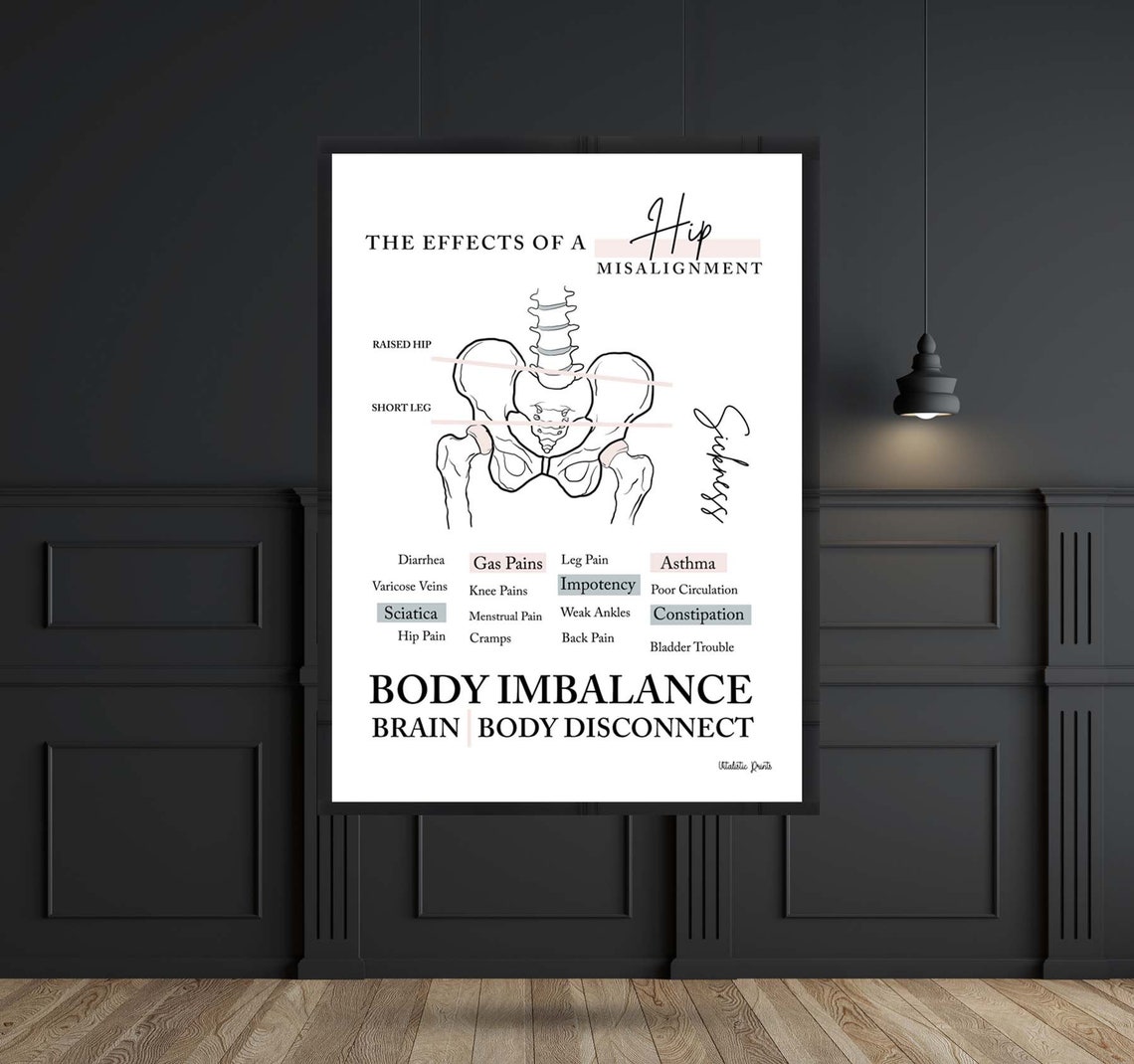 Hip Misalignment Print // Body Imbalance Print // Spinal Nerve Chart ...