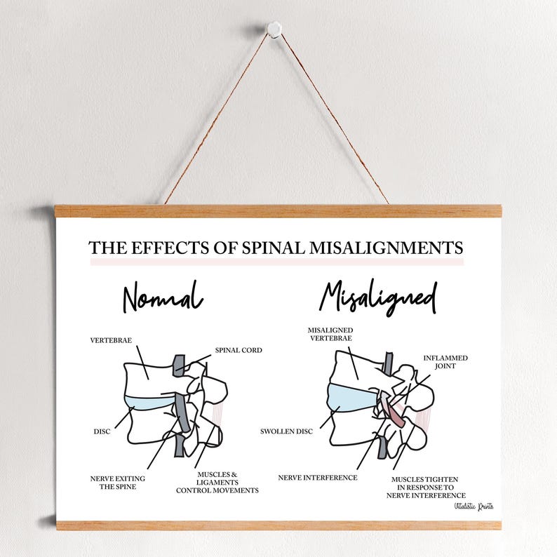 Your Nervous System // Chiropractic // Subluxation Complex // Spinal ...