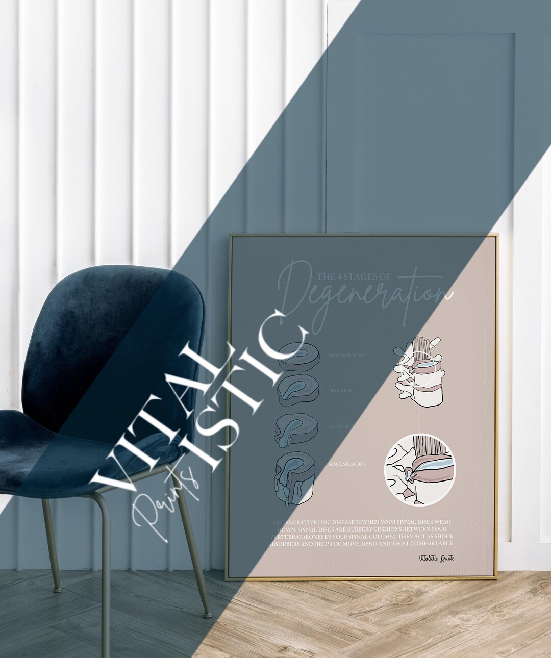 The 4 Stages of Degeneration Print // Spinal Nerve Chart ...