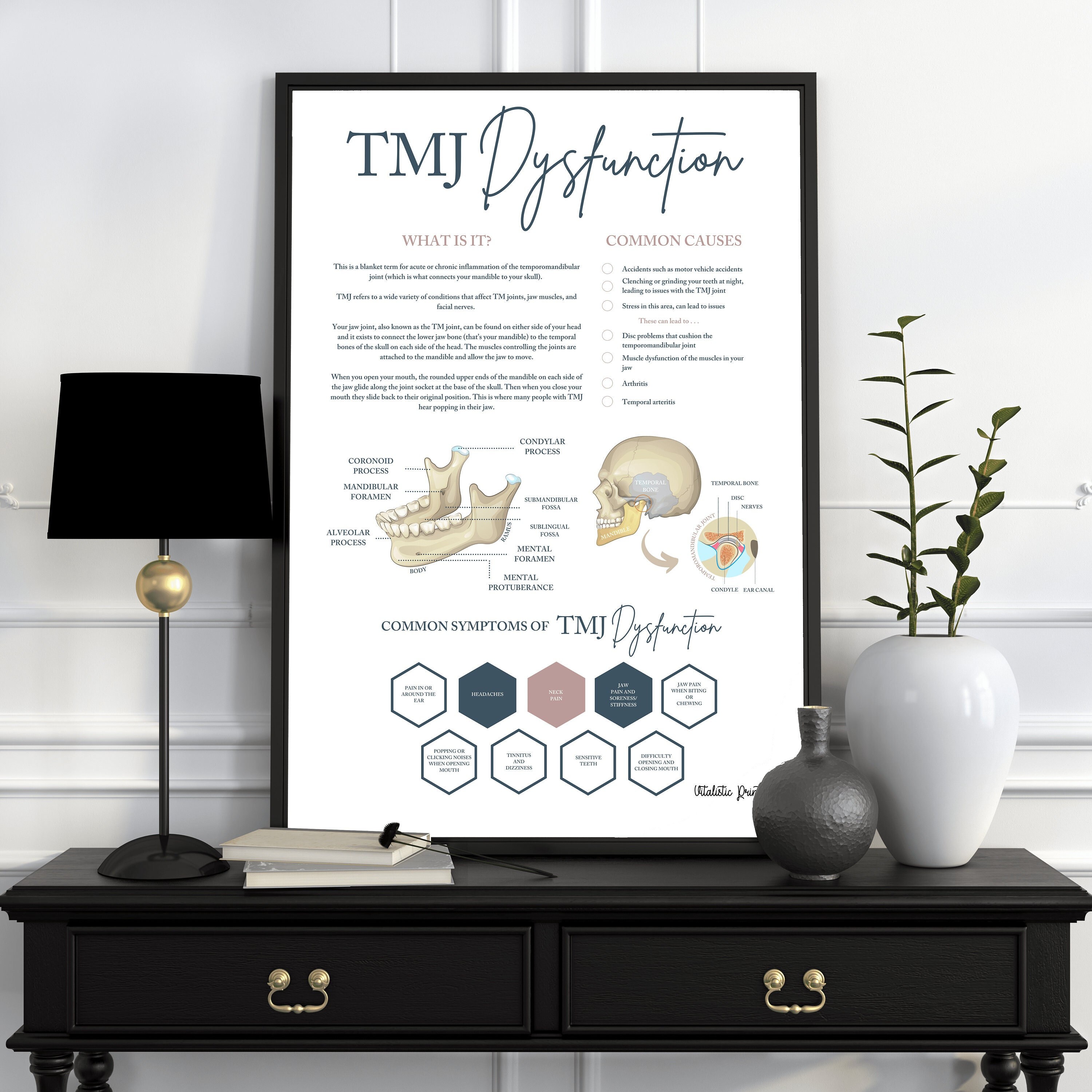 TMJ Dysfunction // Chiropractic // Jaw Pain // Subluxation // Anatomy ...
