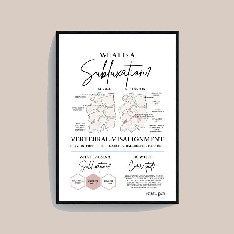 Subluxation Print // Chiropractic // Subluxation Complex // Misalignment Print // Nervous System ...