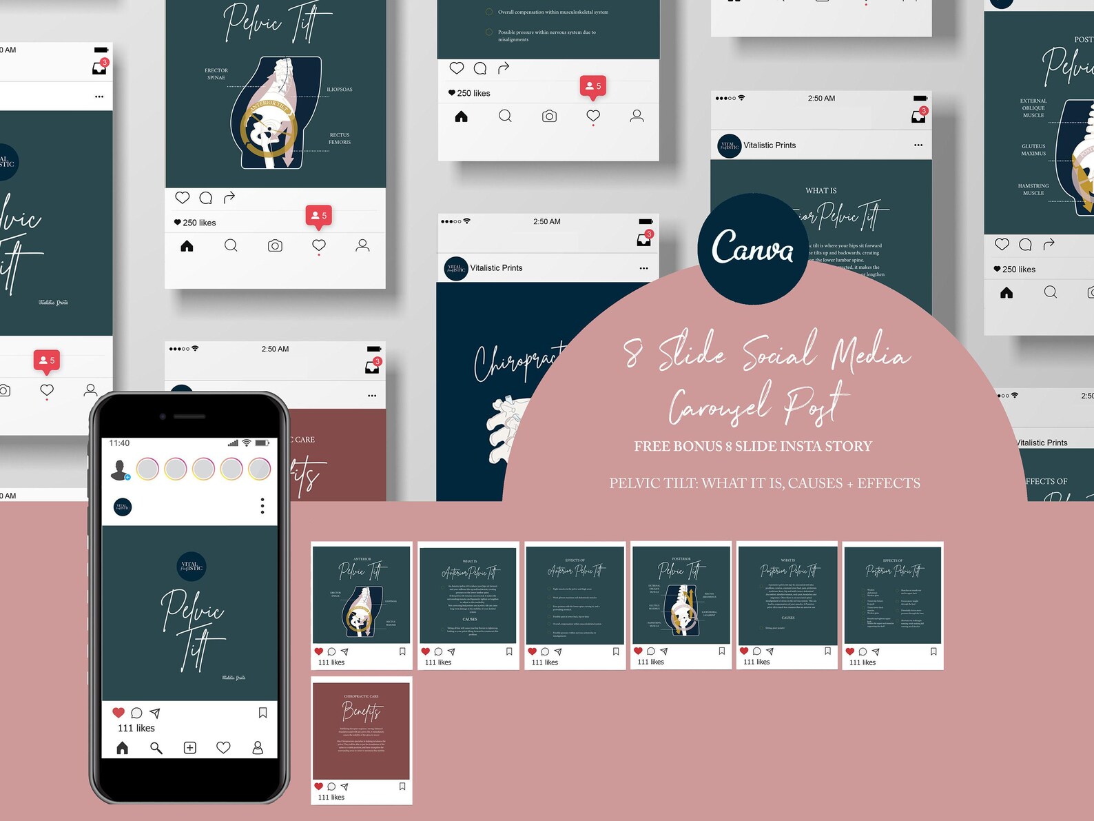 Chiropractic Canva Template for Instagram Post // Pelvic Tilt ...